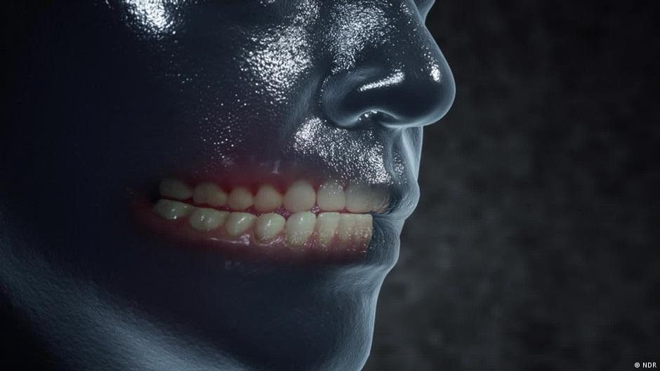 Teeth grinding and clenching: How stress impacts your jaw