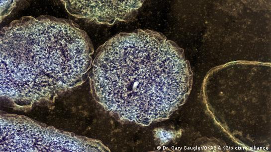 Descubren prometedor compuesto contra bacterias resistentes